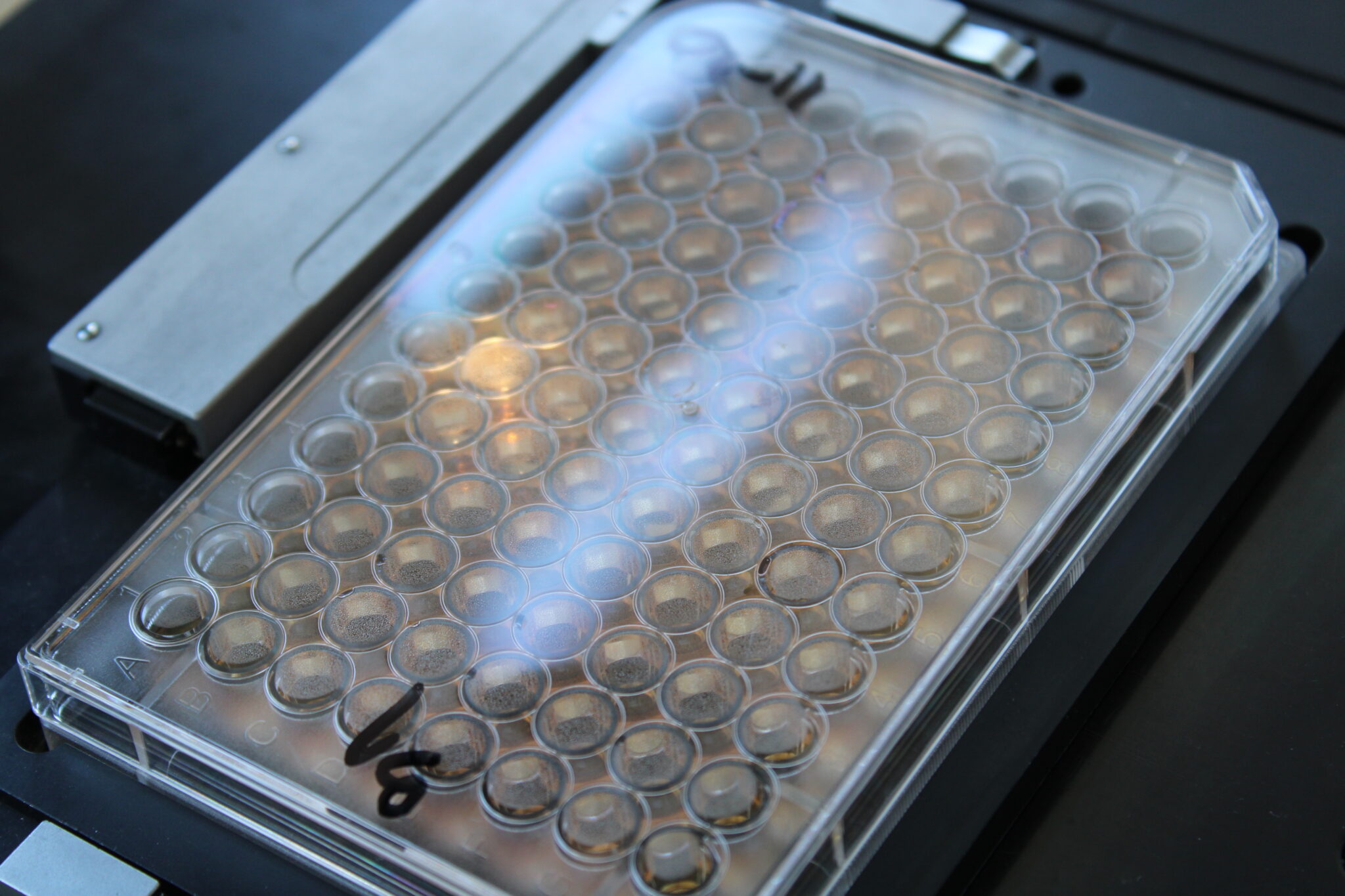 RTS 1, “Torlak“ Institute invites people to test their immune status ...