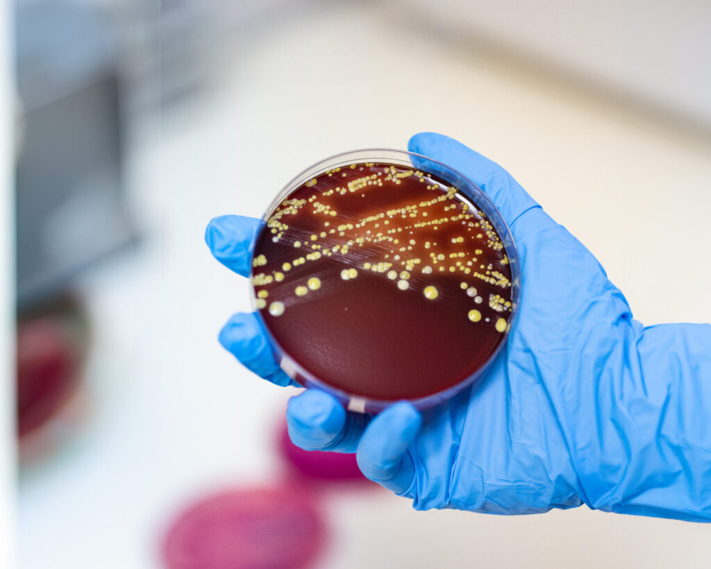 Standard bacteriological diagnostics - Torlak Institute